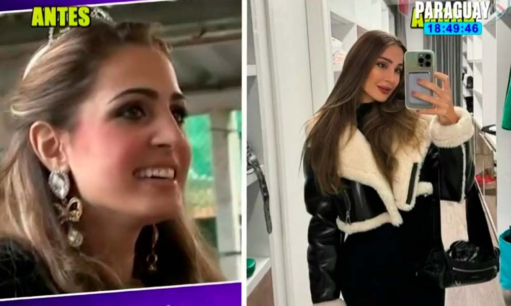 Magaly Medina al ver el antes y después de Ana Paula Consorte: "Tuvo un ...