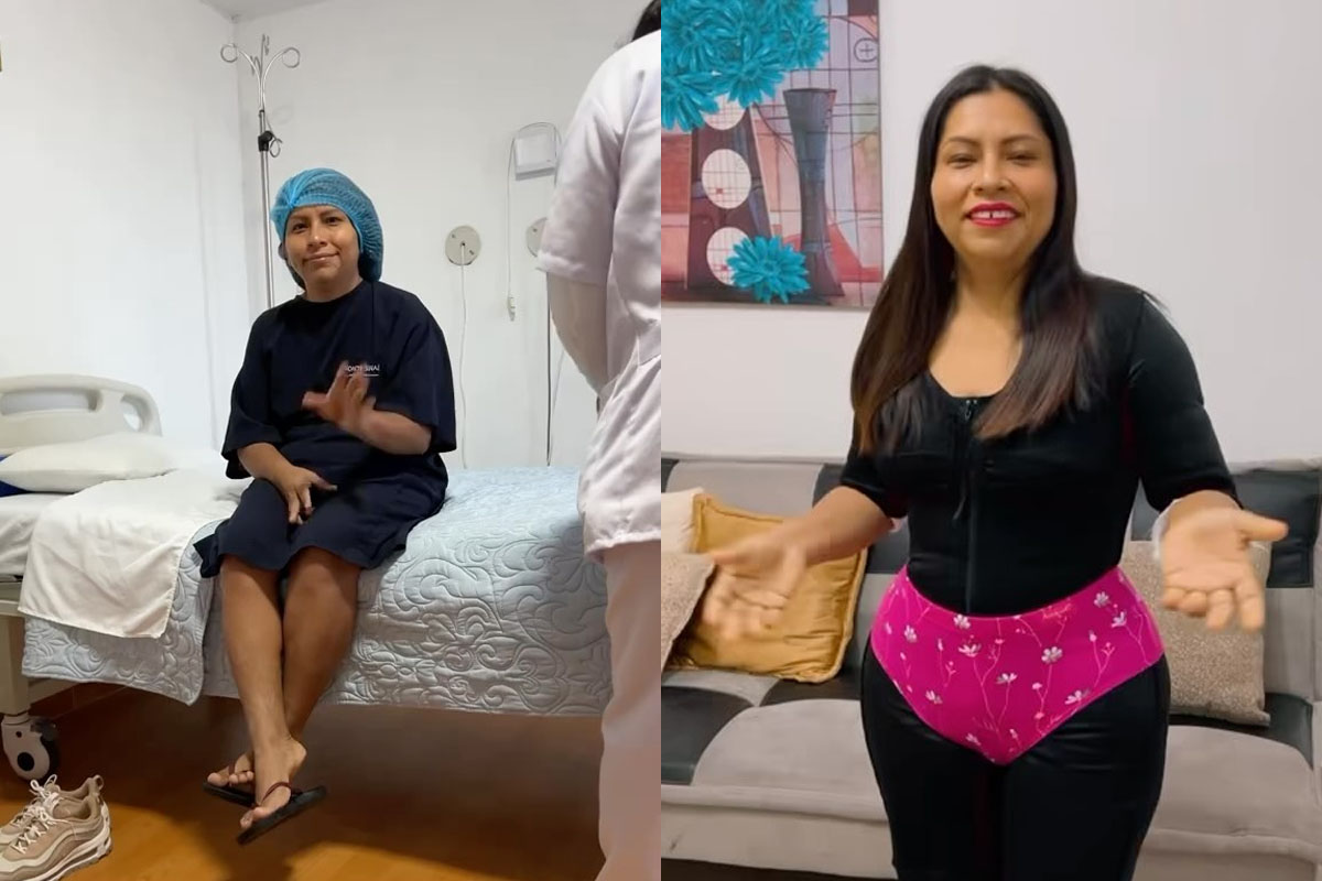 Lis Padilla se hace abdominoplastía y muestra los resultados