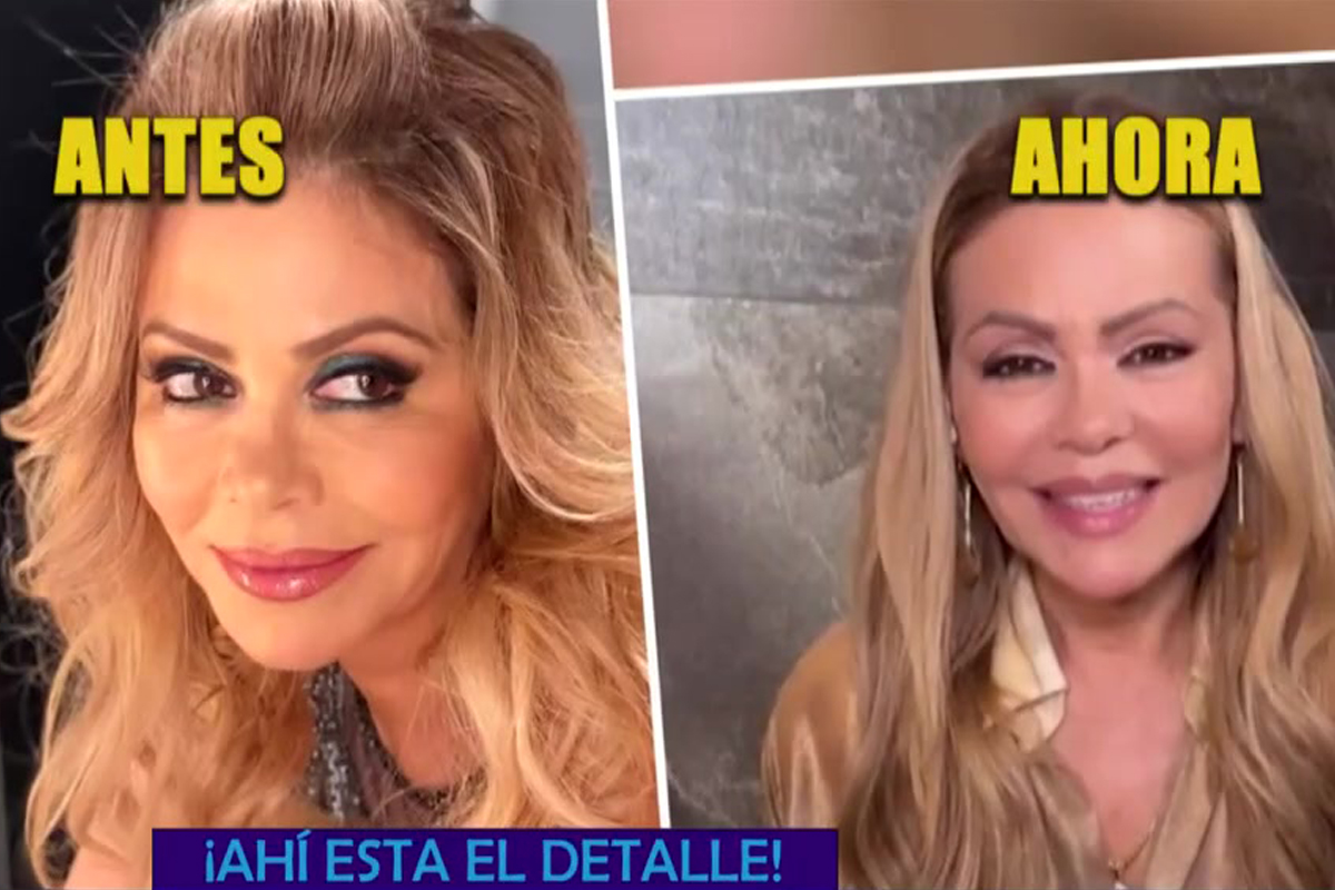 ¿Gisela Valcárcel se hizo varios retoquitos? Especialista explica por ...