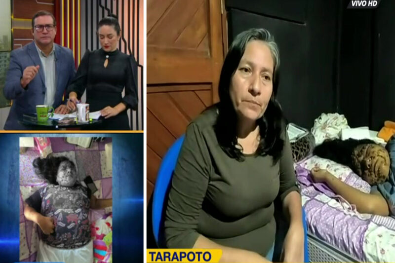 Madre pide ayuda para su hija quien está llena de tumores: "El doctor me dijo que se va a morir ...
