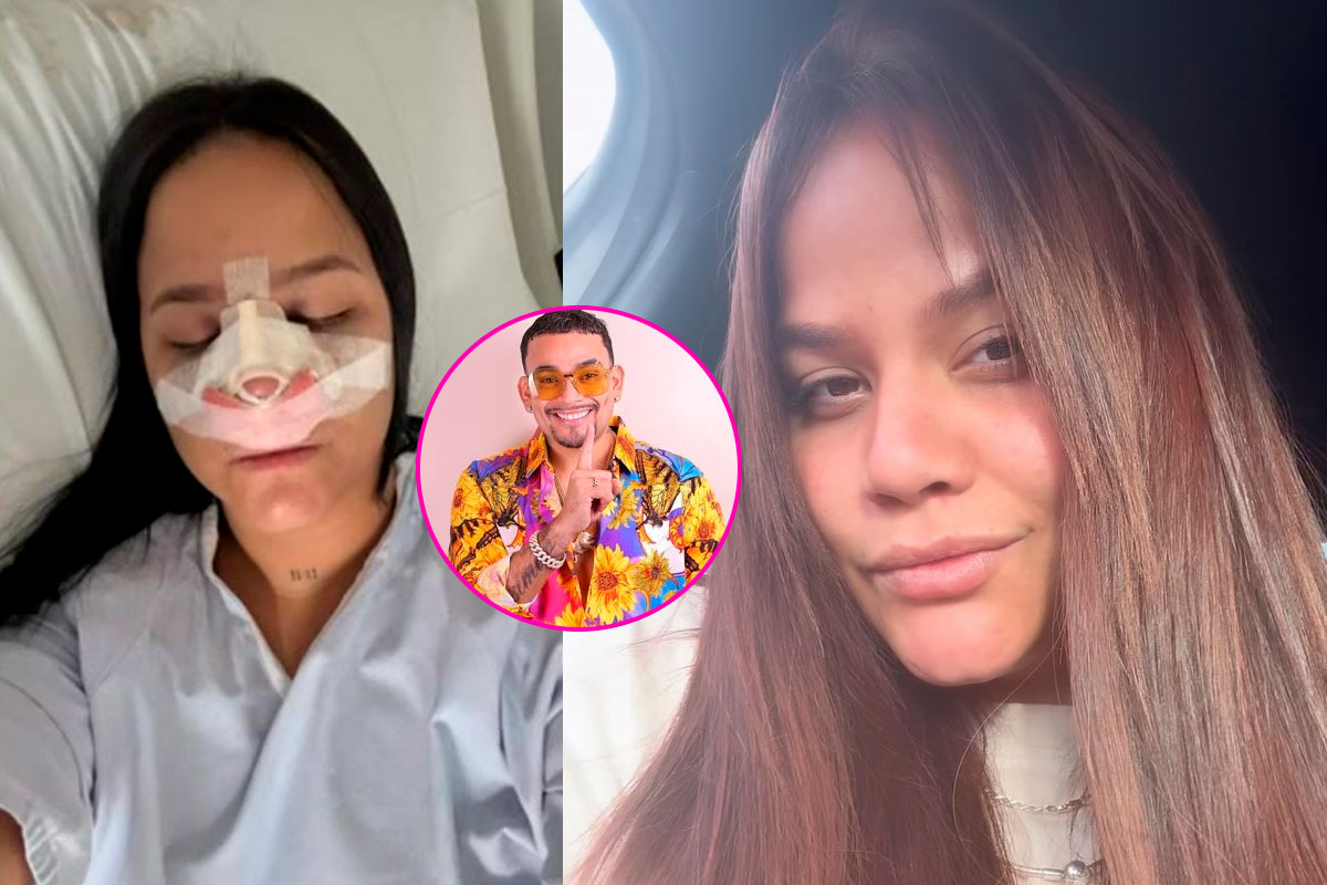 'Prima' de Josimar revela por qué se operó la nariz estando embarazada ...