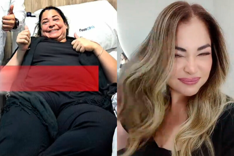 Melanie Martínez luce irreconocible tras manga gástrica y radical ...